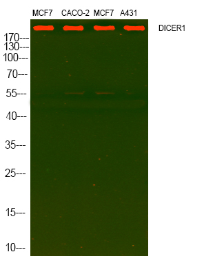 DICER Monoclonal Antibody- ELISA科研检测中心-优品生物官网