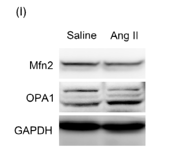 OPA1 Monoclonal Antibody- ELISA科研检测中心-优品生物官网