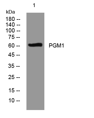PGM1 mouse mAb- ELISA科研检测中心-优品生物官网