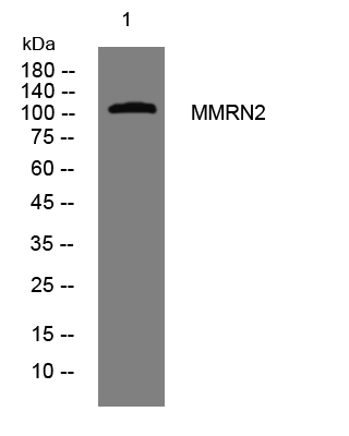 MMRN2 mouse mAb- ELISA科研检测中心-优品生物官网