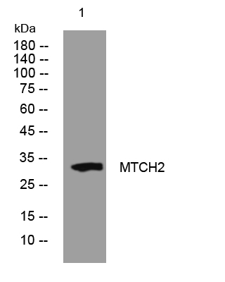 MTCH2 mouse mAb- ELISA科研检测中心-优品生物官网