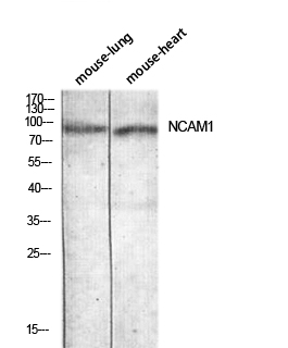 CD56 Monoclonal Antibody- ELISA科研检测中心-优品生物官网