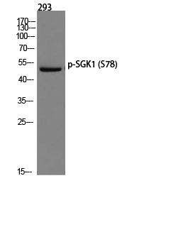 SGK1 (phospho Ser78) Monoclonal Antibody- ELISA科研检测中心-优品生物官网