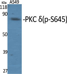 PKC δ (phospho Ser645) Monoclonal Antibody- ELISA科研检测中心-优品生物官网