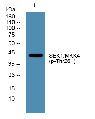 SEK1/MKK4 (phospho-Thr261) mouse mAb- ELISA科研检测中心-优品生物官网