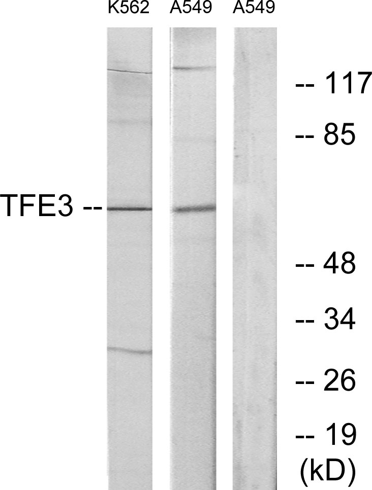 TFE3 Monoclonal Antibody- ELISA科研检测中心-优品生物官网