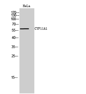 CYP11A1 Monoclonal Antibody- ELISA科研检测中心-优品生物官网