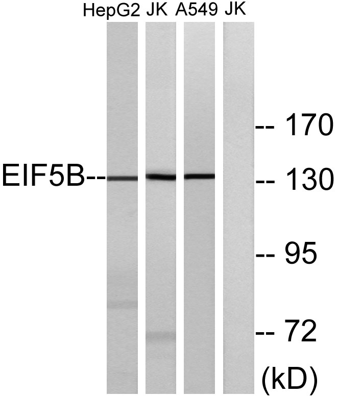 eIF5B Monoclonal Antibody- ELISA科研检测中心-优品生物官网
