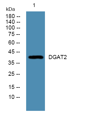 DGAT2 Monoclonal Antibody- ELISA科研检测中心-优品生物官网