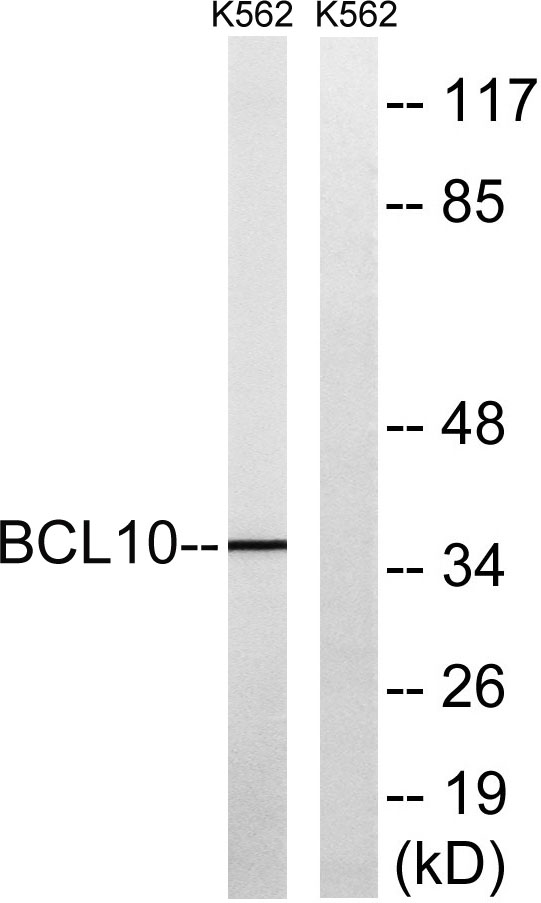 Bcl-10 Monoclonal Antibody- ELISA科研检测中心-优品生物官网