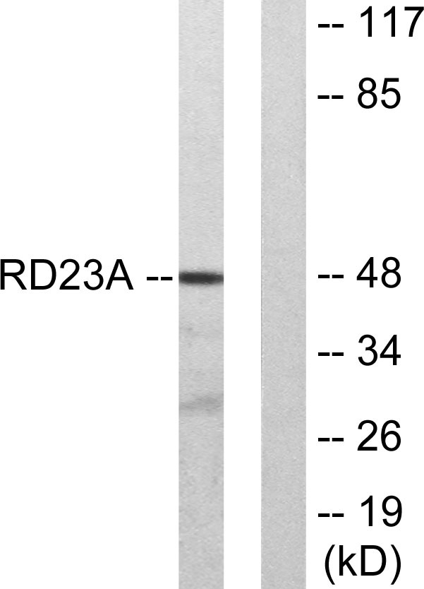 Rad23A Monoclonal Antibody- ELISA科研检测中心-优品生物官网