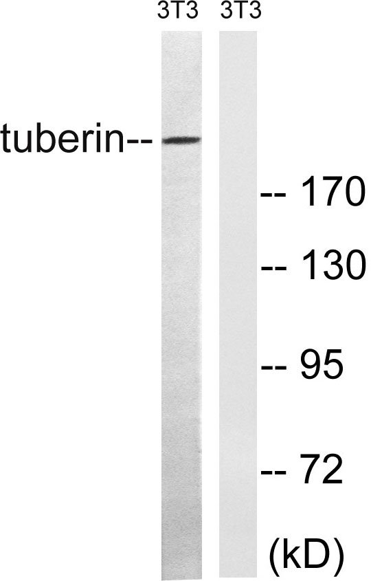 Tuberin Monoclonal Antibody- ELISA科研检测中心-优品生物官网