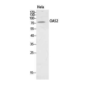 OAS2 Monoclonal Antibody- ELISA科研检测中心-优品生物官网