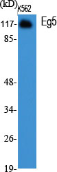 Eg5 Monoclonal Antibody- ELISA科研检测中心-优品生物官网