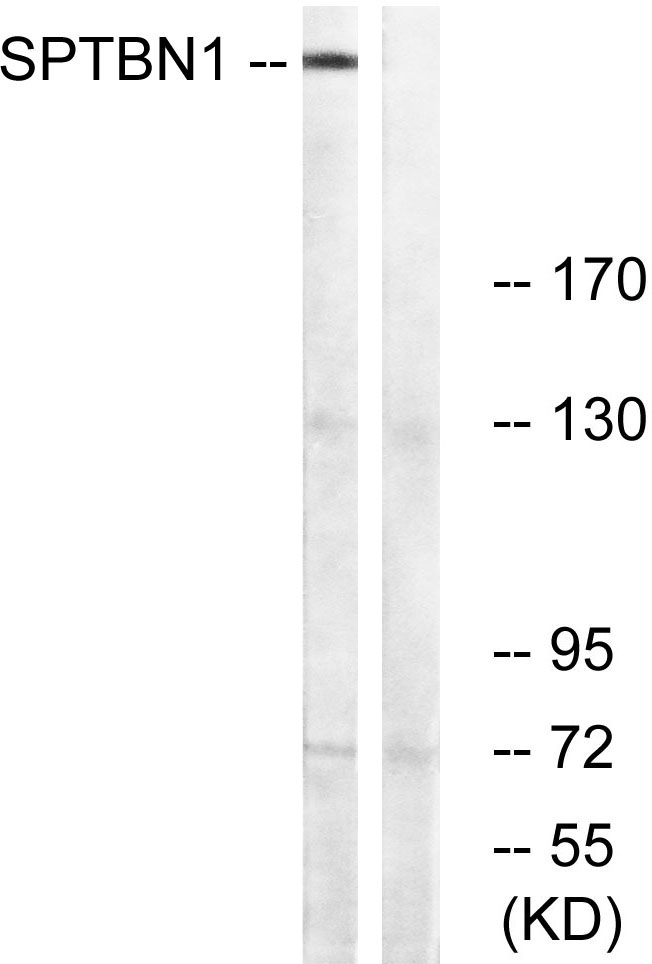Spectrin β II Monoclonal Antibody- ELISA科研检测中心-优品生物官网
