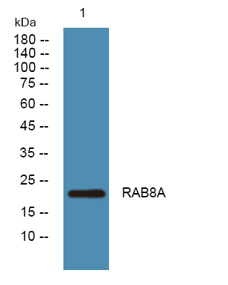 RAB8A Monoclonal Antibody- ELISA科研检测中心-优品生物官网