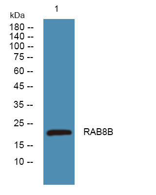 RAB8B Monoclonal Antibody- ELISA科研检测中心-优品生物官网