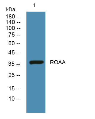 ROAA Monoclonal Antibody- ELISA科研检测中心-优品生物官网