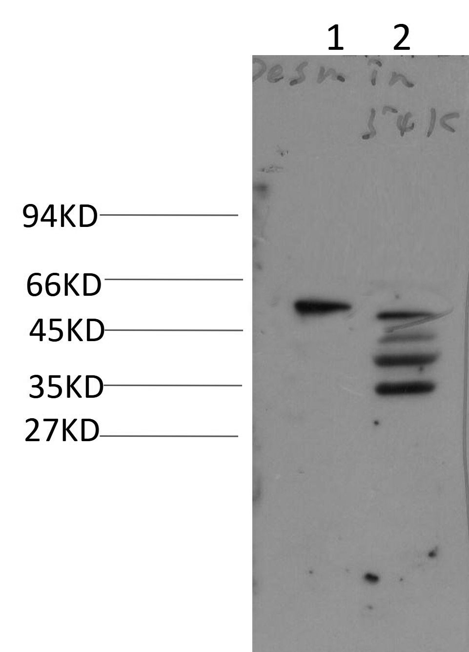 Desmin mouse mAb- ELISA科研检测中心-优品生物官网