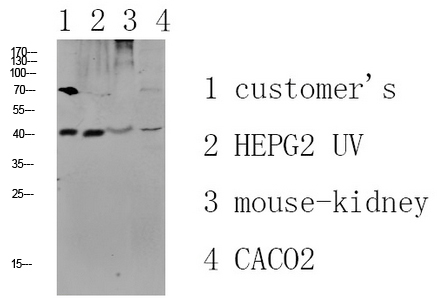 CCR5 Monoclonal Antibody- ELISA科研检测中心-优品生物官网