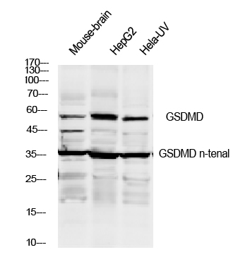 GSDMD N-terminal mouse mAb- ELISA科研检测中心-优品生物官网