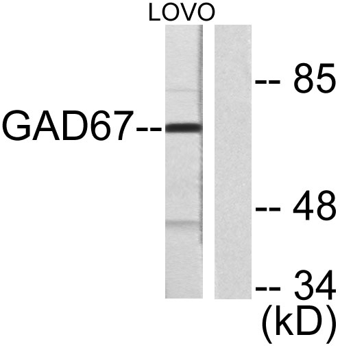GAD67 Monoclonal Antibody- ELISA科研检测中心-优品生物官网