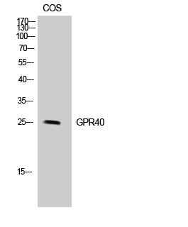 GPR40 Monoclonal Antibody- ELISA科研检测中心-优品生物官网
