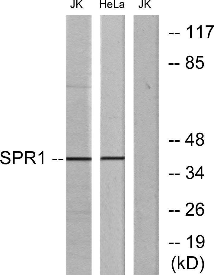 GPR68 Monoclonal Antibody- ELISA科研检测中心-优品生物官网