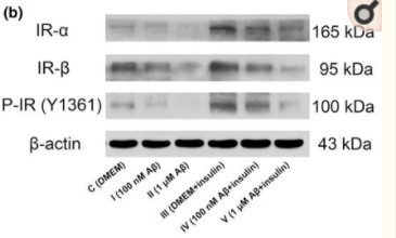 Insulin R Monoclonal Antibody- ELISA科研检测中心-优品生物官网