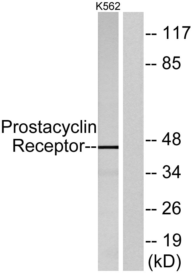IP Receptor Monoclonal Antibody- ELISA科研检测中心-优品生物官网