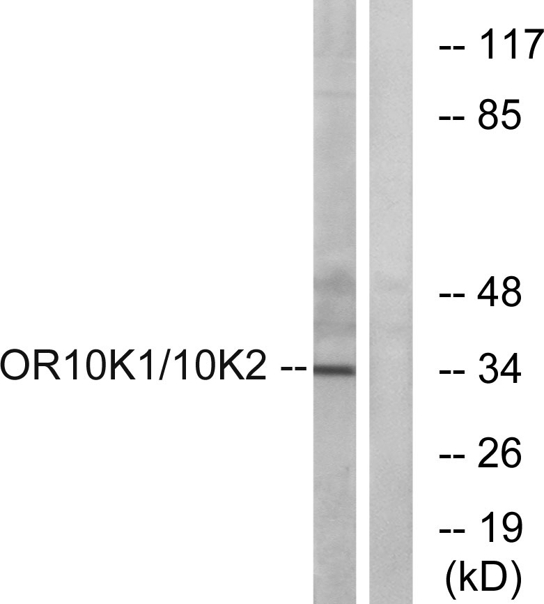 Olfactory receptor 10K1/2 Monoclonal Antibody- ELISA科研检测中心-优品生物官网