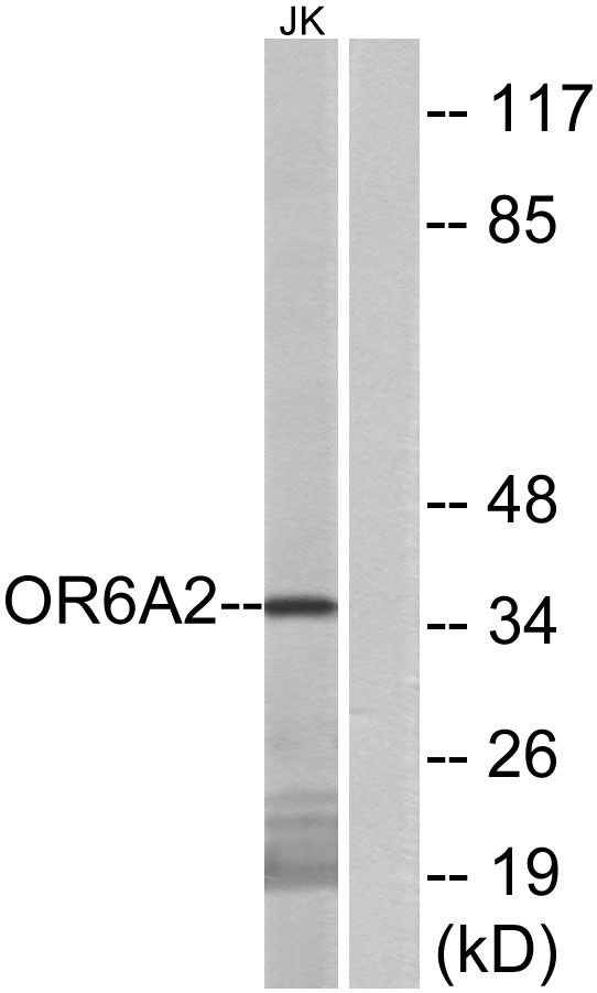 Olfactory receptor 6A2 Monoclonal Antibody- ELISA科研检测中心-优品生物官网