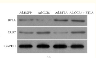 CD272 Monoclonal Antibody- ELISA科研检测中心-优品生物官网