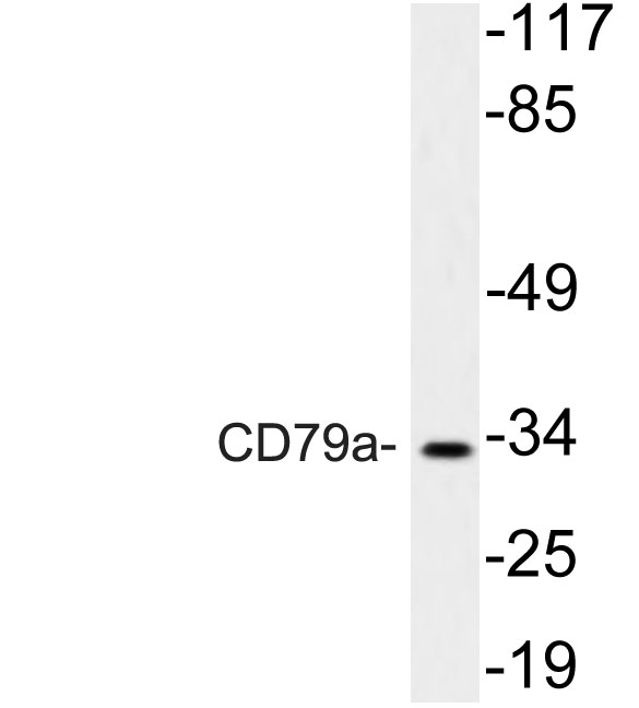 CD79a Monoclonal Antibody- ELISA科研检测中心-优品生物官网