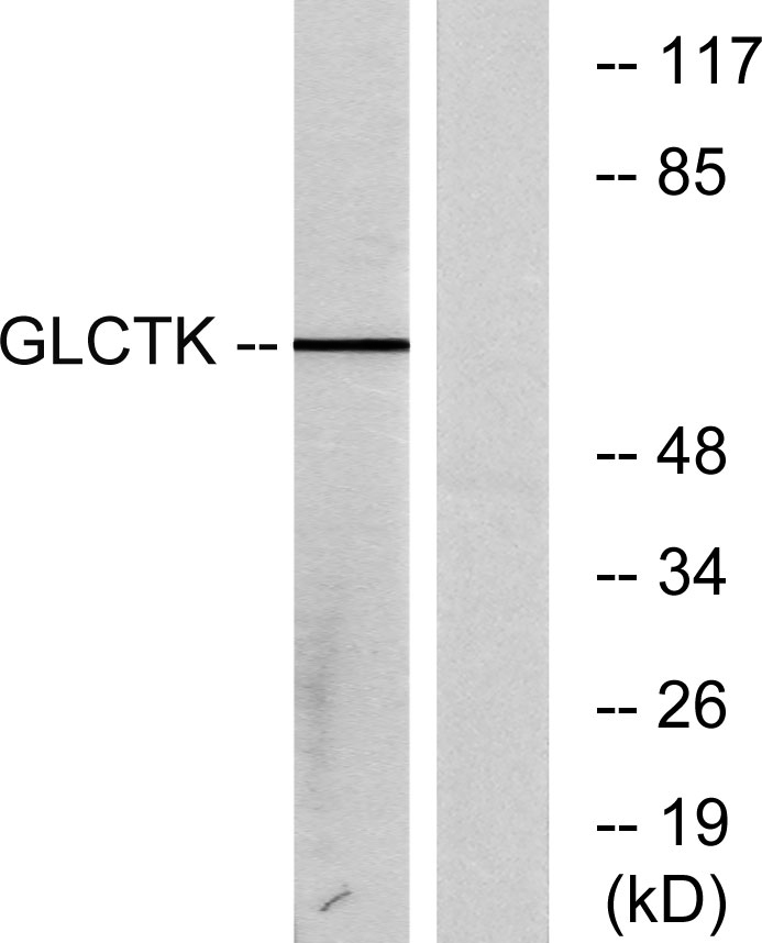 Glycerate Kinase Monoclonal Antibody- ELISA科研检测中心-优品生物官网