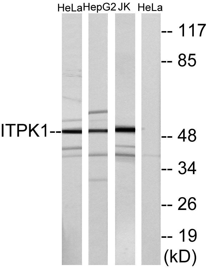 ITPK1 Monoclonal Antibody- ELISA科研检测中心-优品生物官网