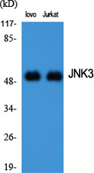 JNK3 Monoclonal Antibody- ELISA科研检测中心-优品生物官网