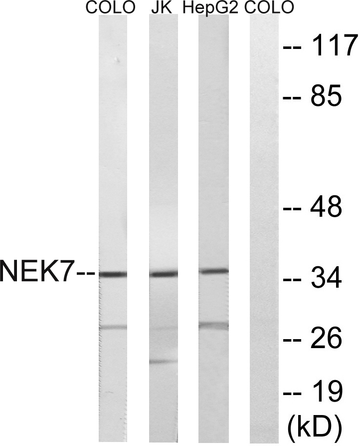 Nek7 Monoclonal Antibody- ELISA科研检测中心-优品生物官网
