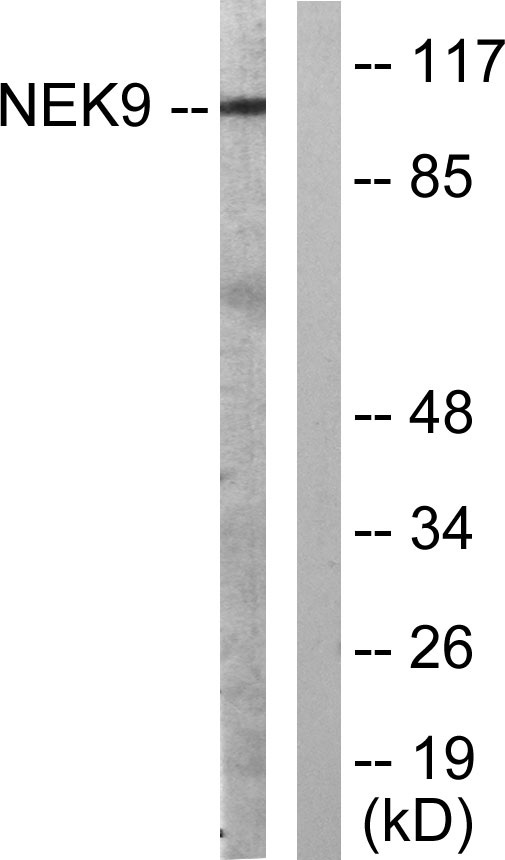 Nek9 Monoclonal Antibody- ELISA科研检测中心-优品生物官网