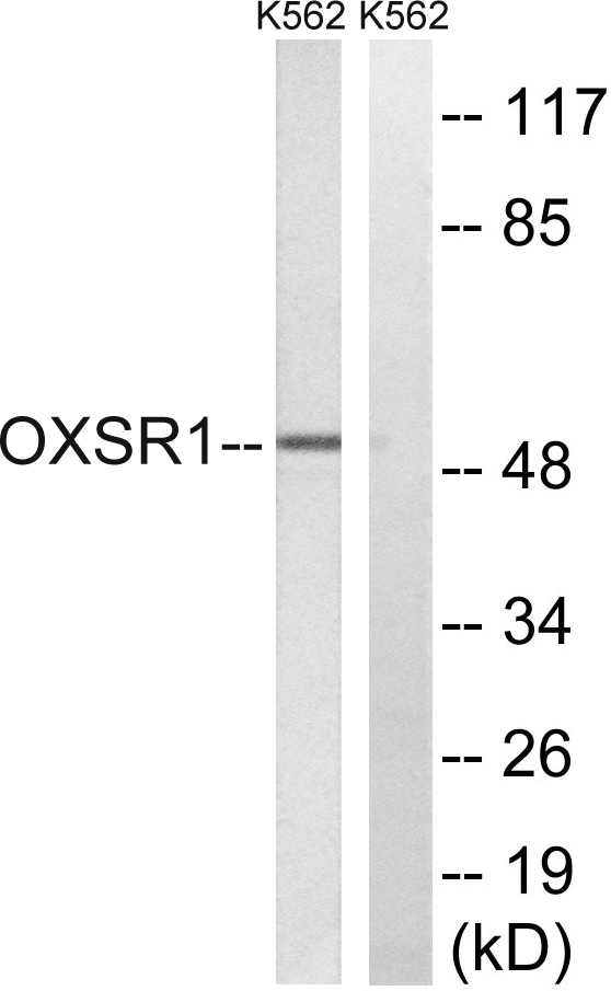 OXSR1 Monoclonal Antibody- ELISA科研检测中心-优品生物官网