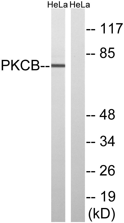 PKC β Monoclonal Antibody- ELISA科研检测中心-优品生物官网