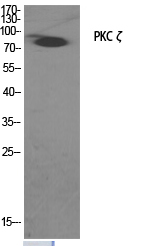 PKC ζ Monoclonal Antibody- ELISA科研检测中心-优品生物官网
