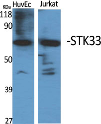 STK33 Monoclonal Antibody- ELISA科研检测中心-优品生物官网