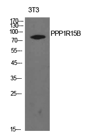 PPP1R15B Monoclonal Antibody- ELISA科研检测中心-优品生物官网
