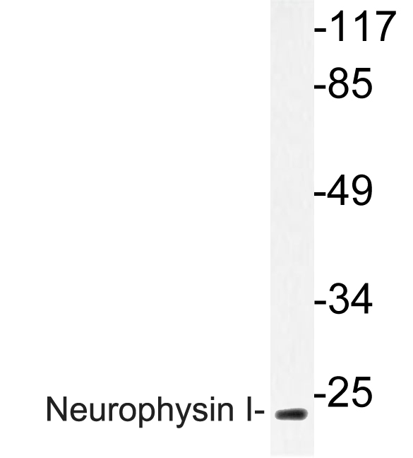 Neurophysin I Monoclonal Antibody- ELISA科研检测中心-优品生物官网
