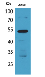 BMP-3A Monoclonal Antibody- ELISA科研检测中心-优品生物官网