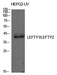 Lefty Monoclonal Antibody- ELISA科研检测中心-优品生物官网