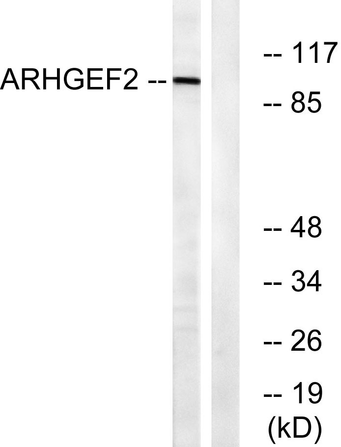 Lfc Monoclonal Antibody- ELISA科研检测中心-优品生物官网