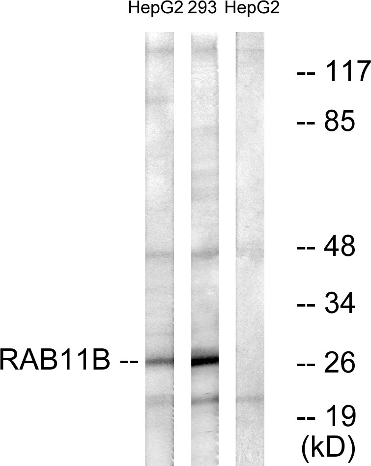 Rab 11B Monoclonal Antibody- ELISA科研检测中心-优品生物官网