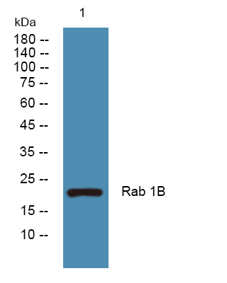 Rab 1B Monoclonal Antibody- ELISA科研检测中心-优品生物官网